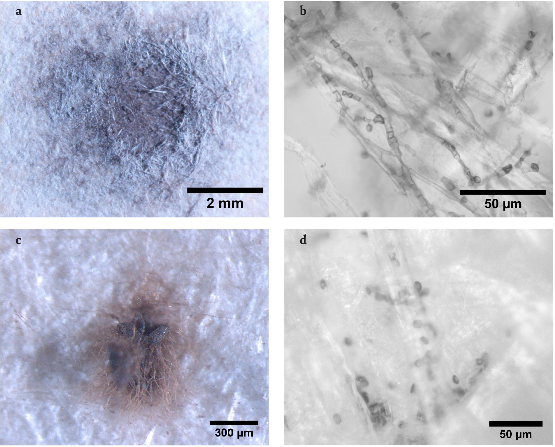 Stereo microscopy and om images of stains and fungal