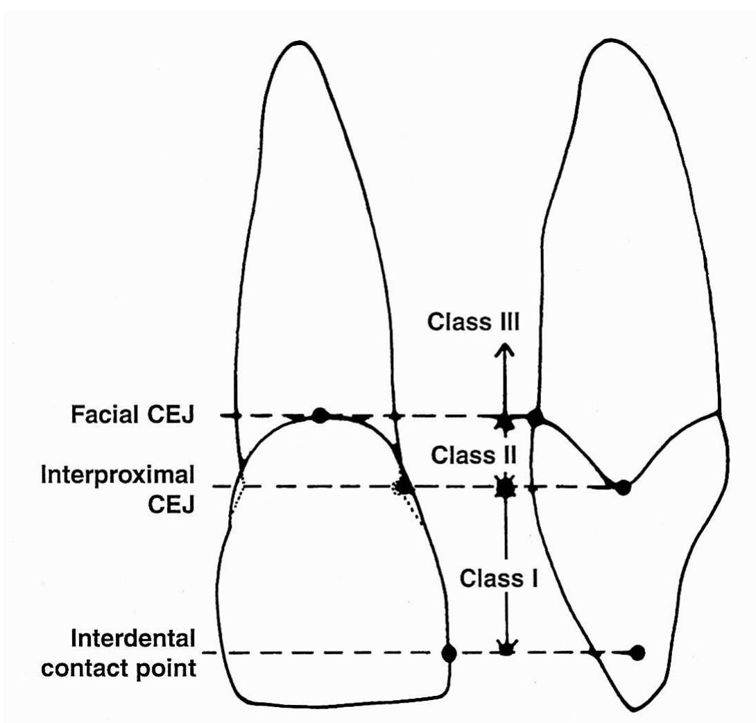 Figure 1 - from A Classification System for Loss of
