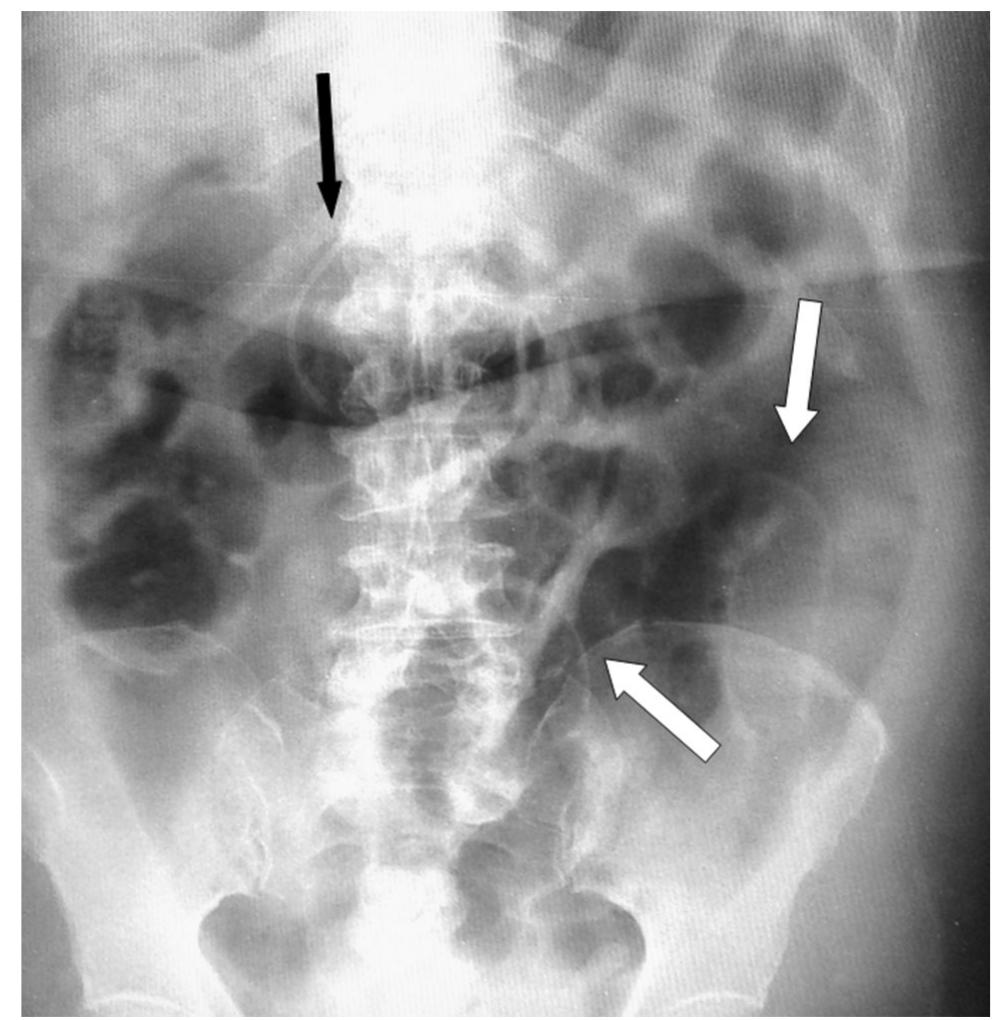 Figure 1 - from Rigler sign