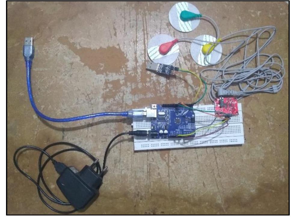Ecg monitoring system setup the procedure of electrical