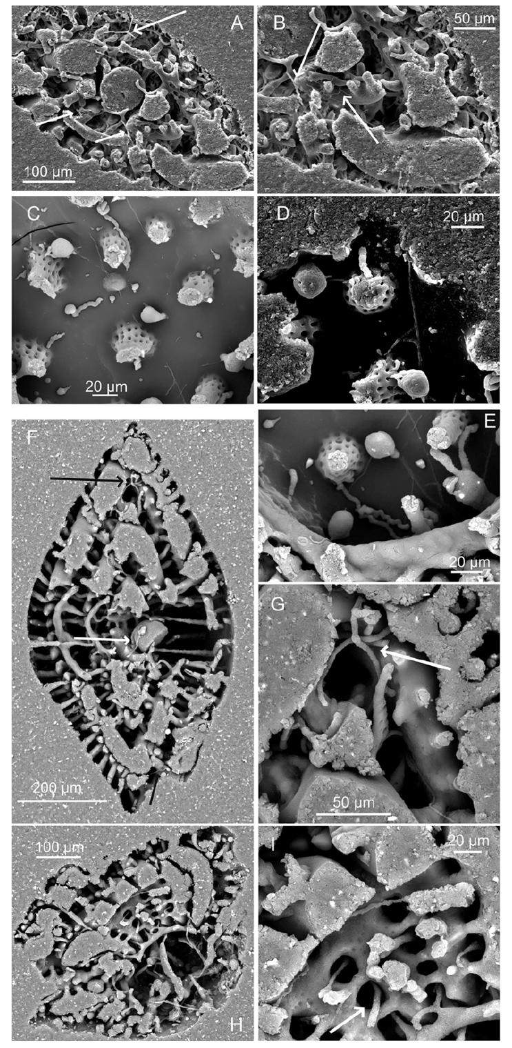 Sem images of hyaline foraminifera resin casts. (a)