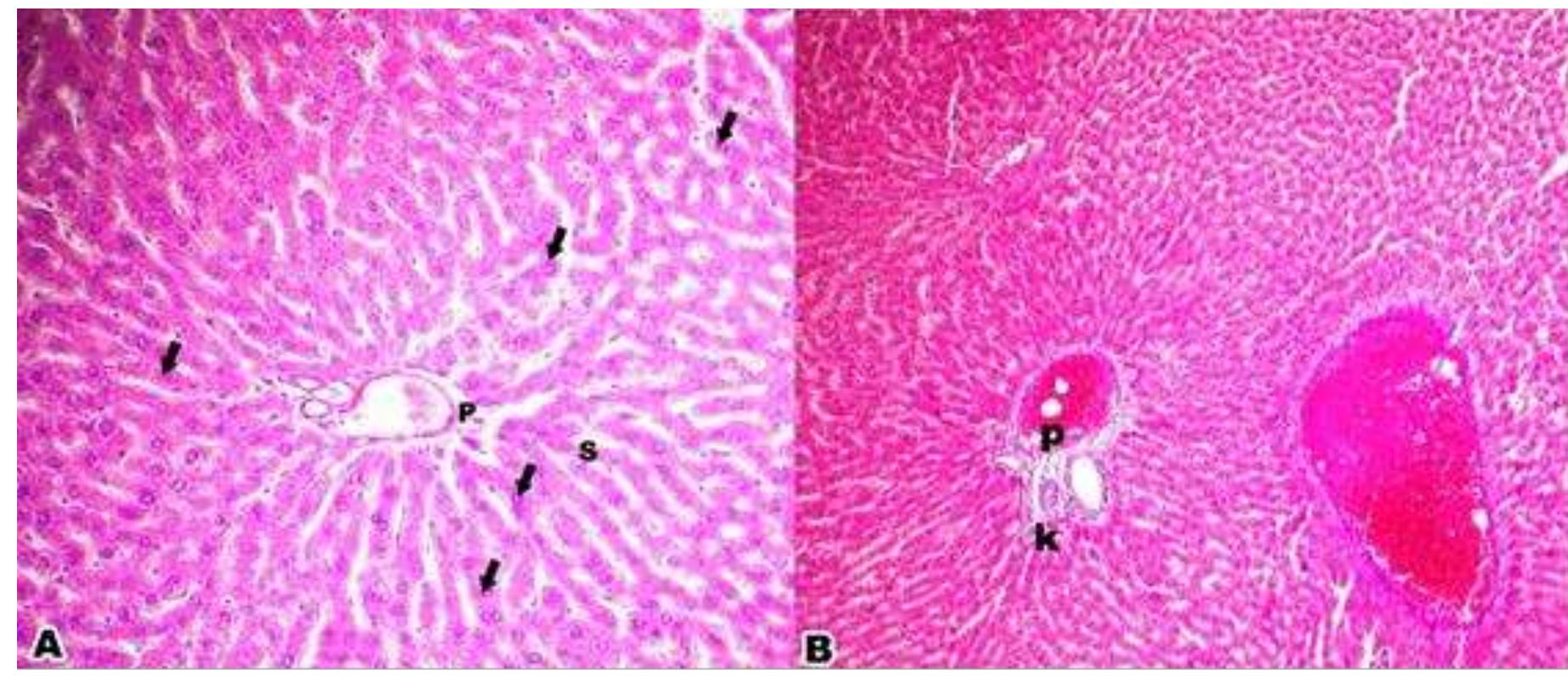 Pic. 6 histological appearance of the liver in group ii.