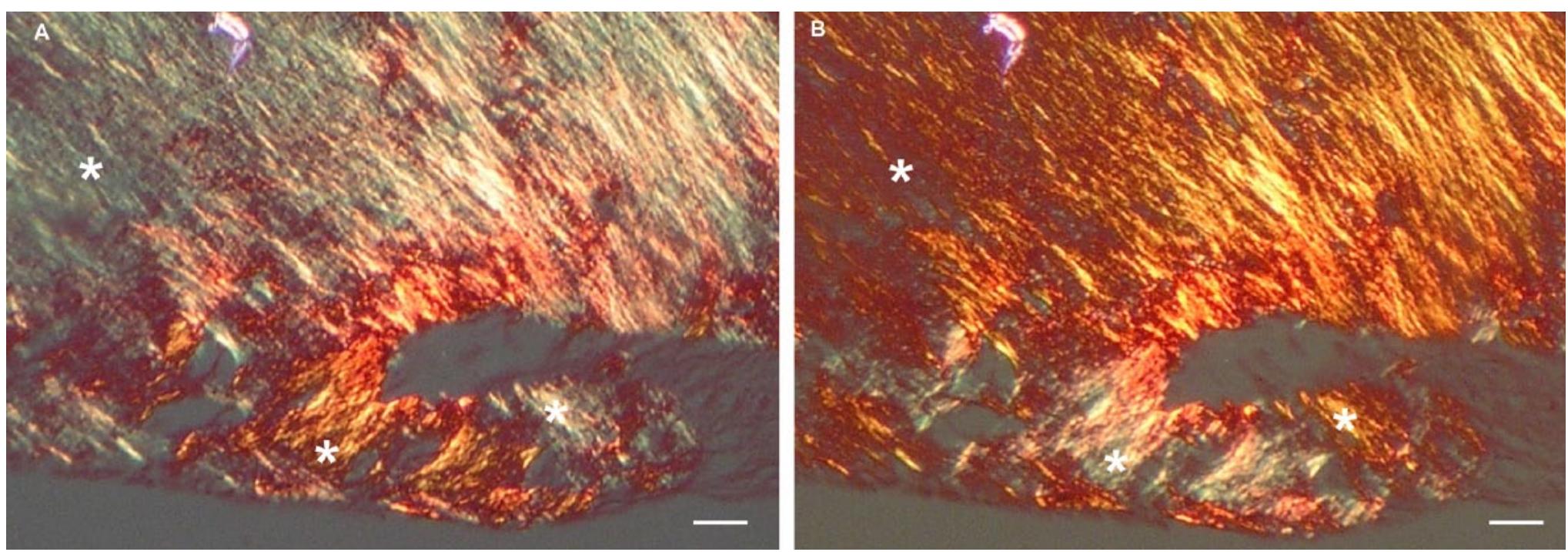(PDF) Picrosirius Red Staining: A Useful Tool to Appraise Collagen ...