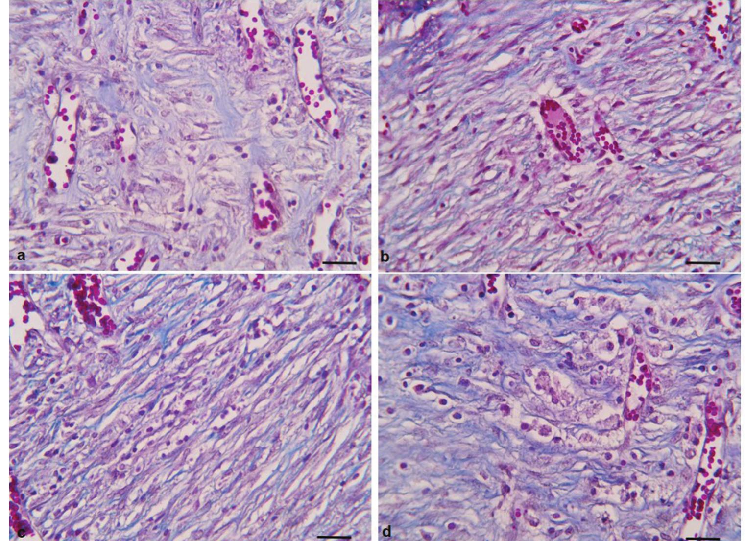 Photomicrograph of dermal wound samples on day 7 for all the