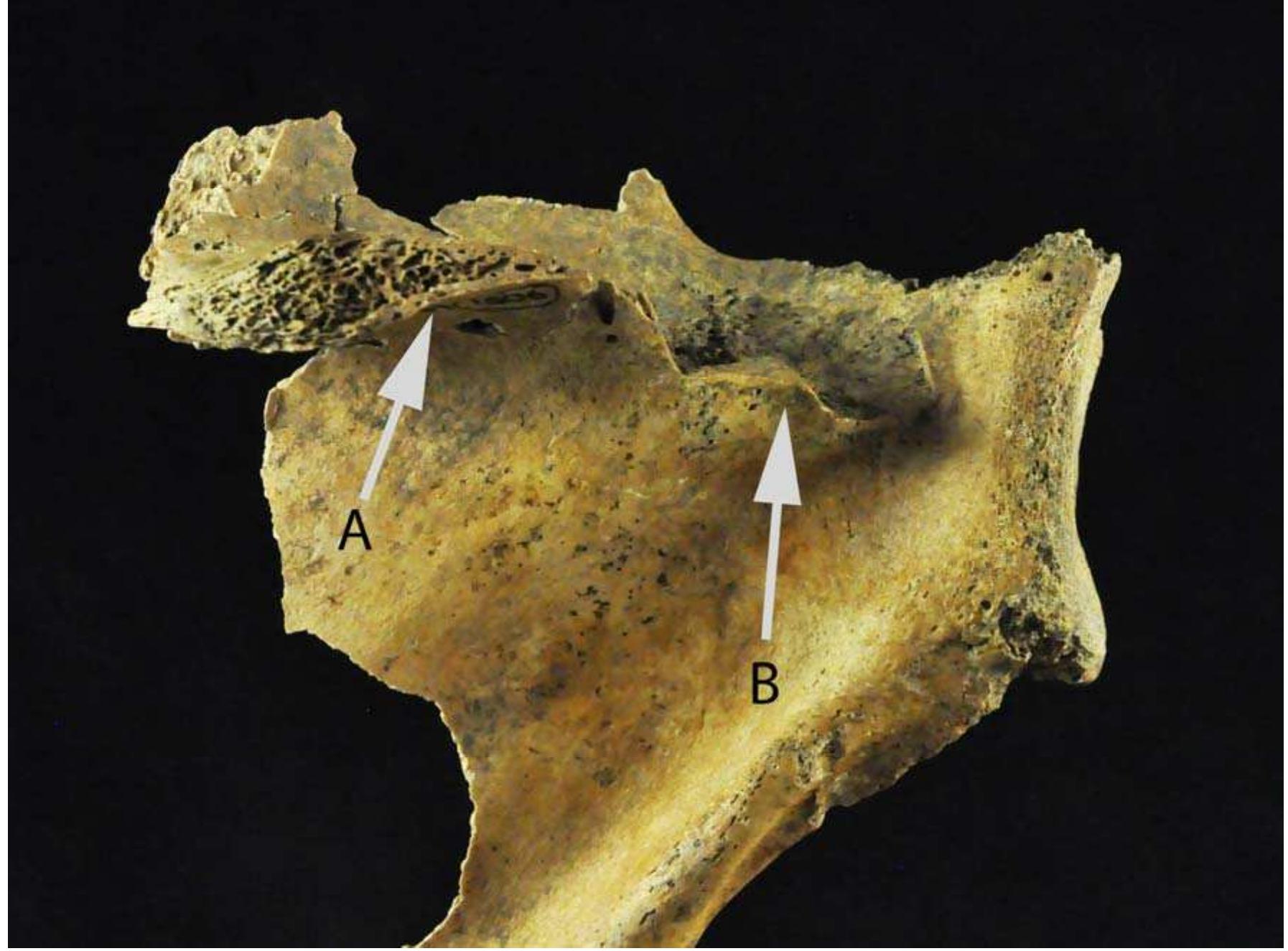 Close-up of the posterior scapula showing the cut mark (a)