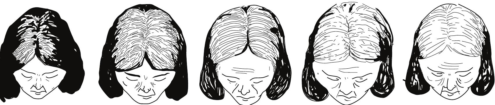 'igure 3: sinclair scale: 5-point scale for grading of fphl