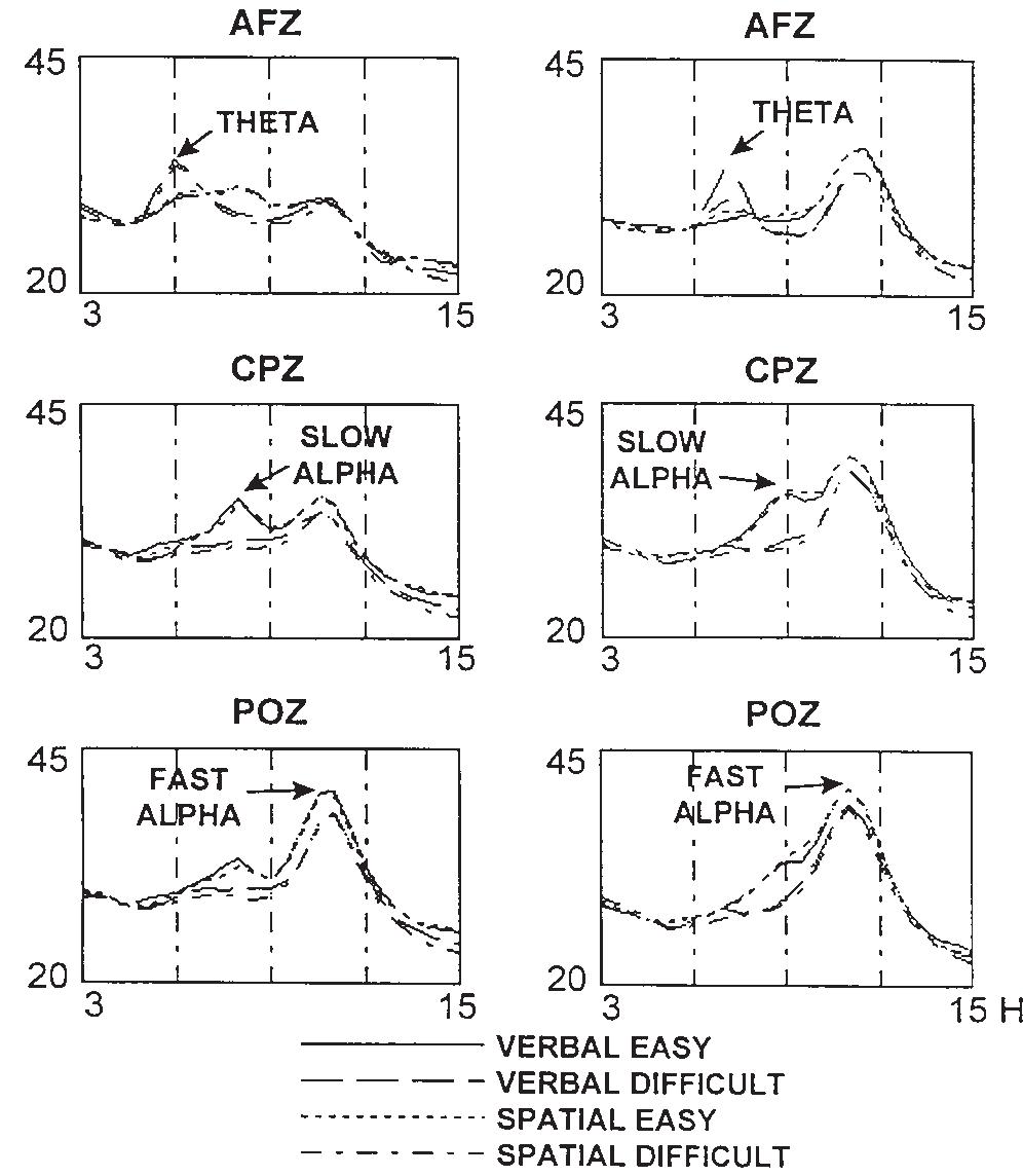Figure 3 - High-resolution EEG mapping of cortical