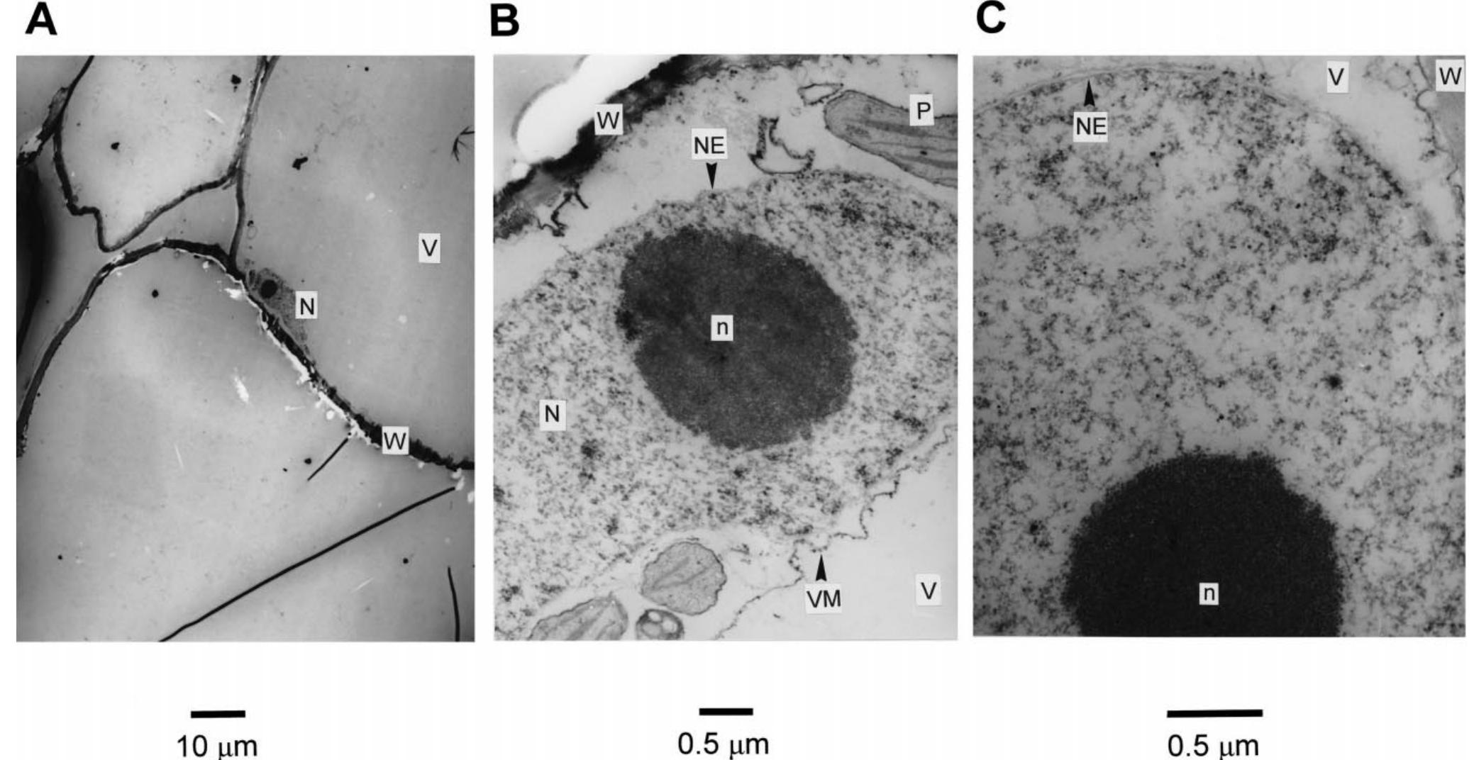Examples of electron micrographs of red beet tissue slices.