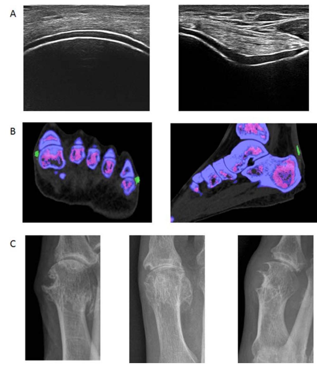 Examples of imaging features included in the classification