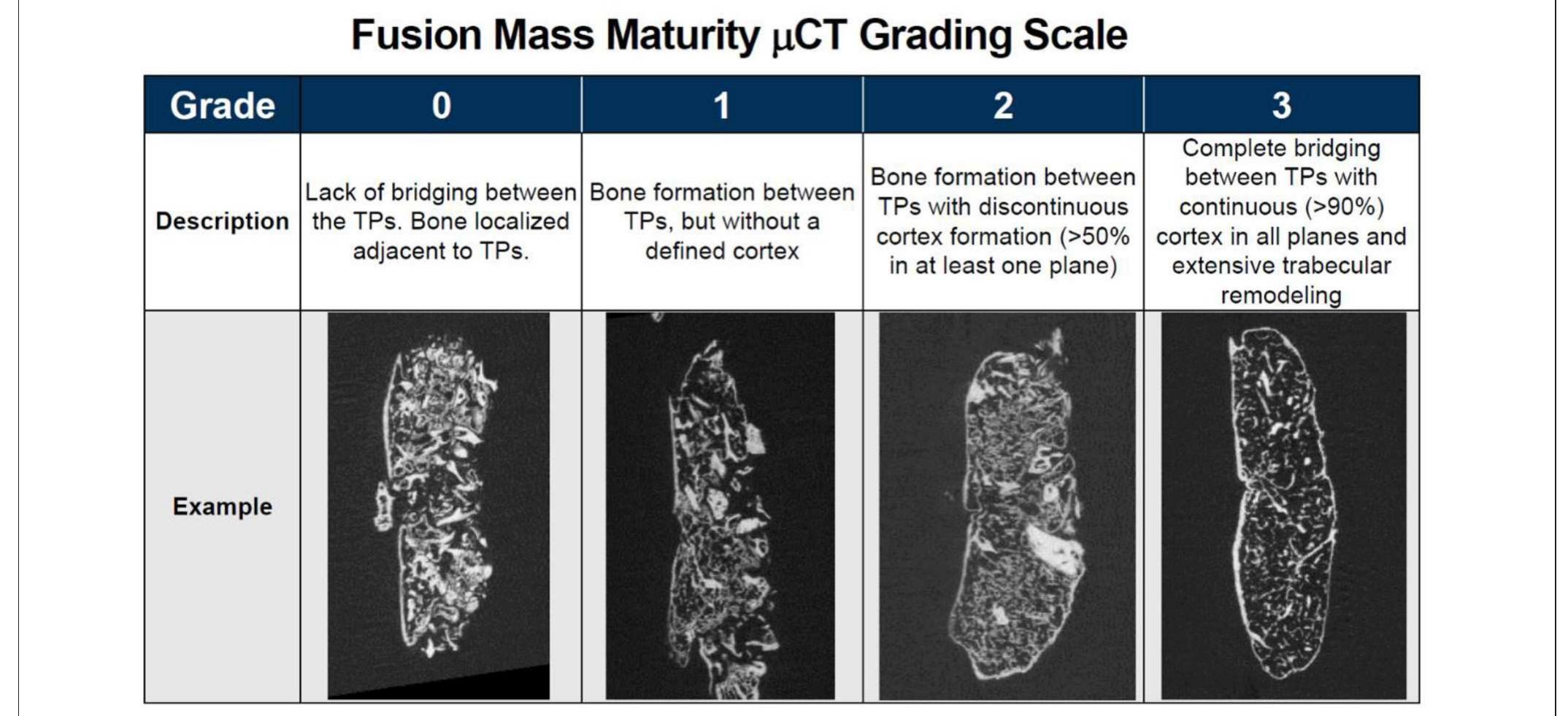 | qualitative fusion mass maturity ct grading scale with