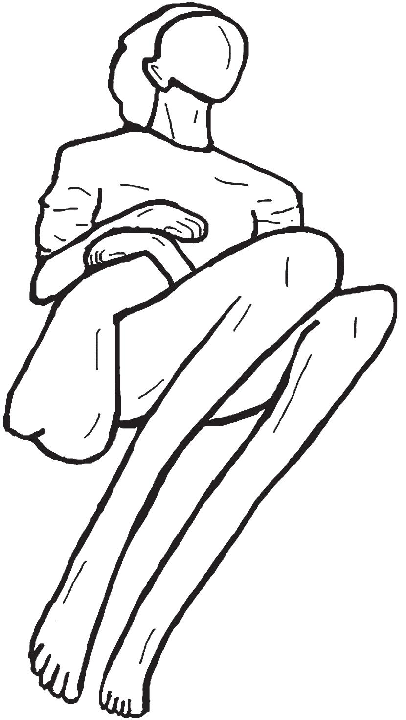 Typical (fetal) posture of patient with advanced paratonia