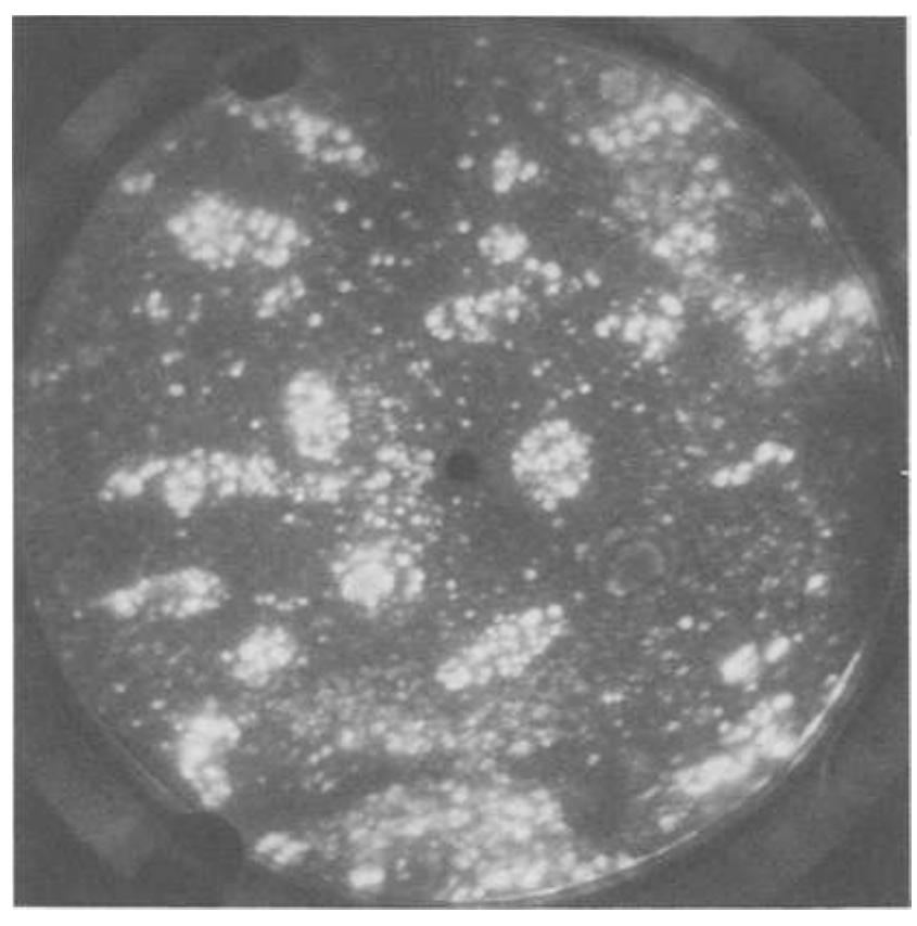 —field-ion micrograph of a precipitated area in a c-300 mar-