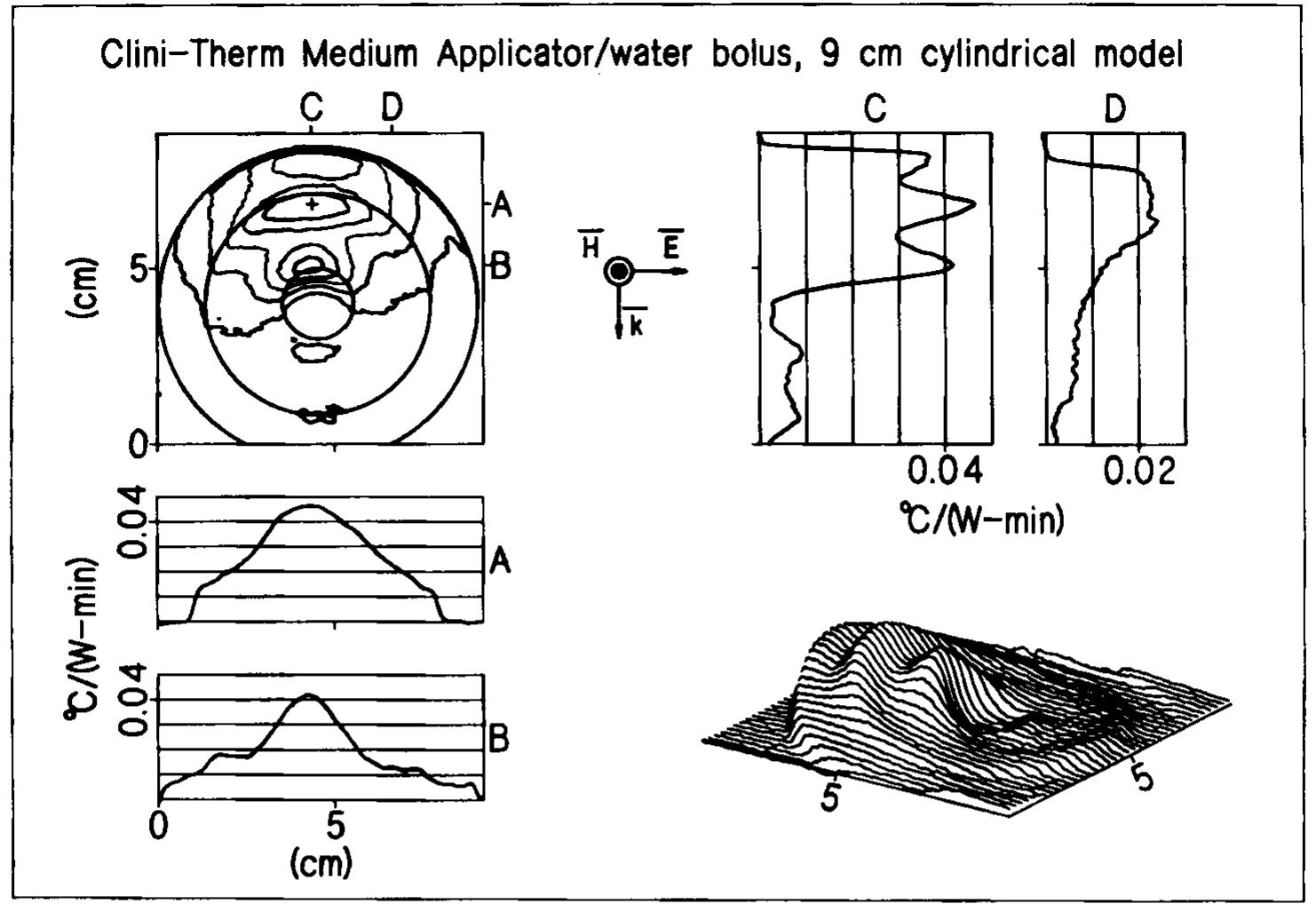 Transverse heating patterns of the clini-therm medium