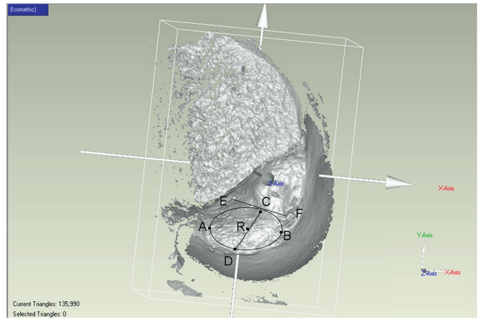 Histologic analysis of the femoral attachment in fetuses