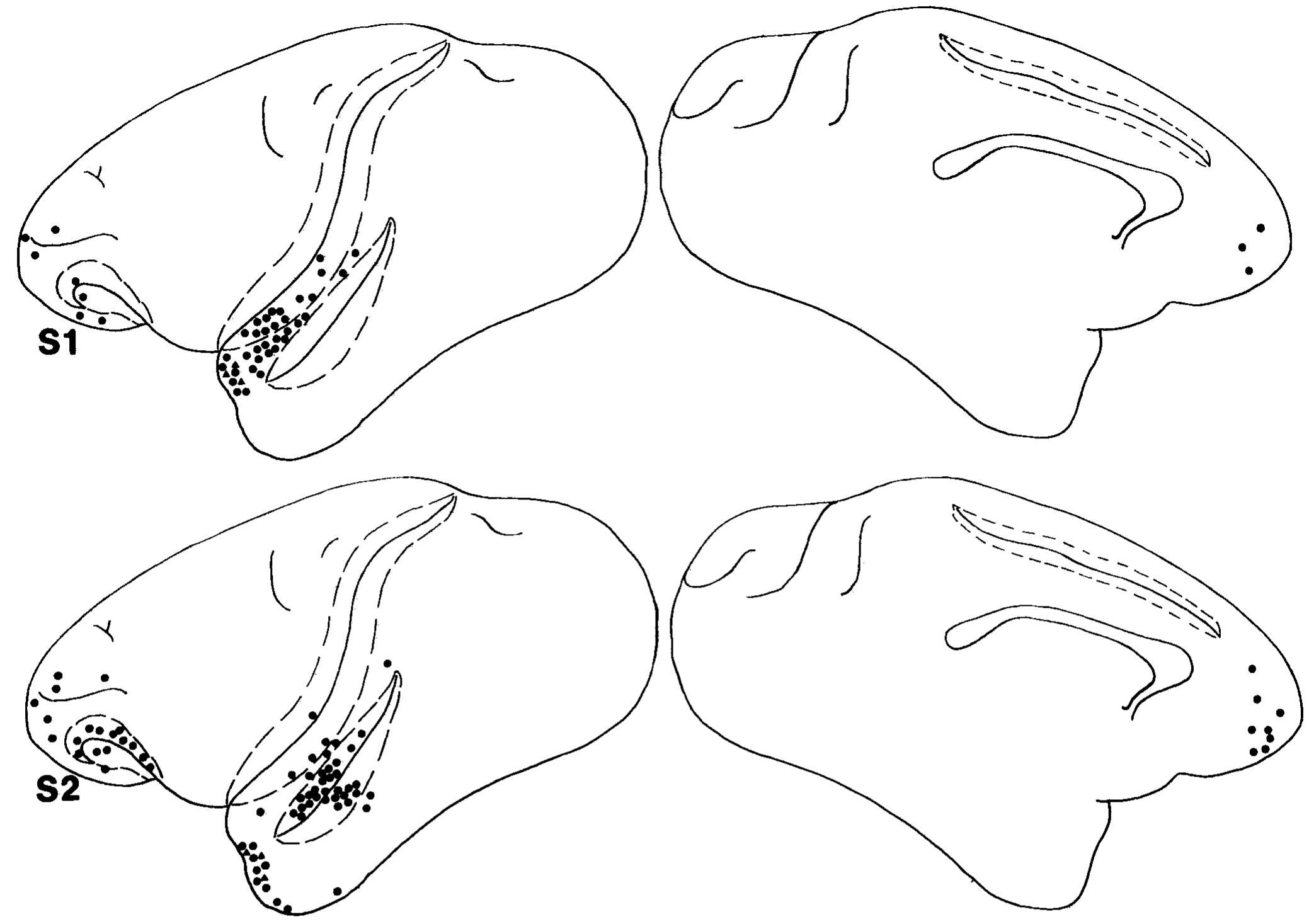 Schematic views of the lateral and medial parts of the