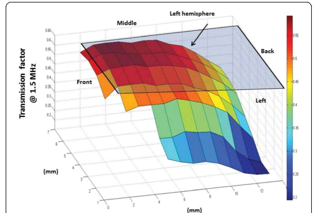 (abstract 092). acoustic transmission factor mapping, i