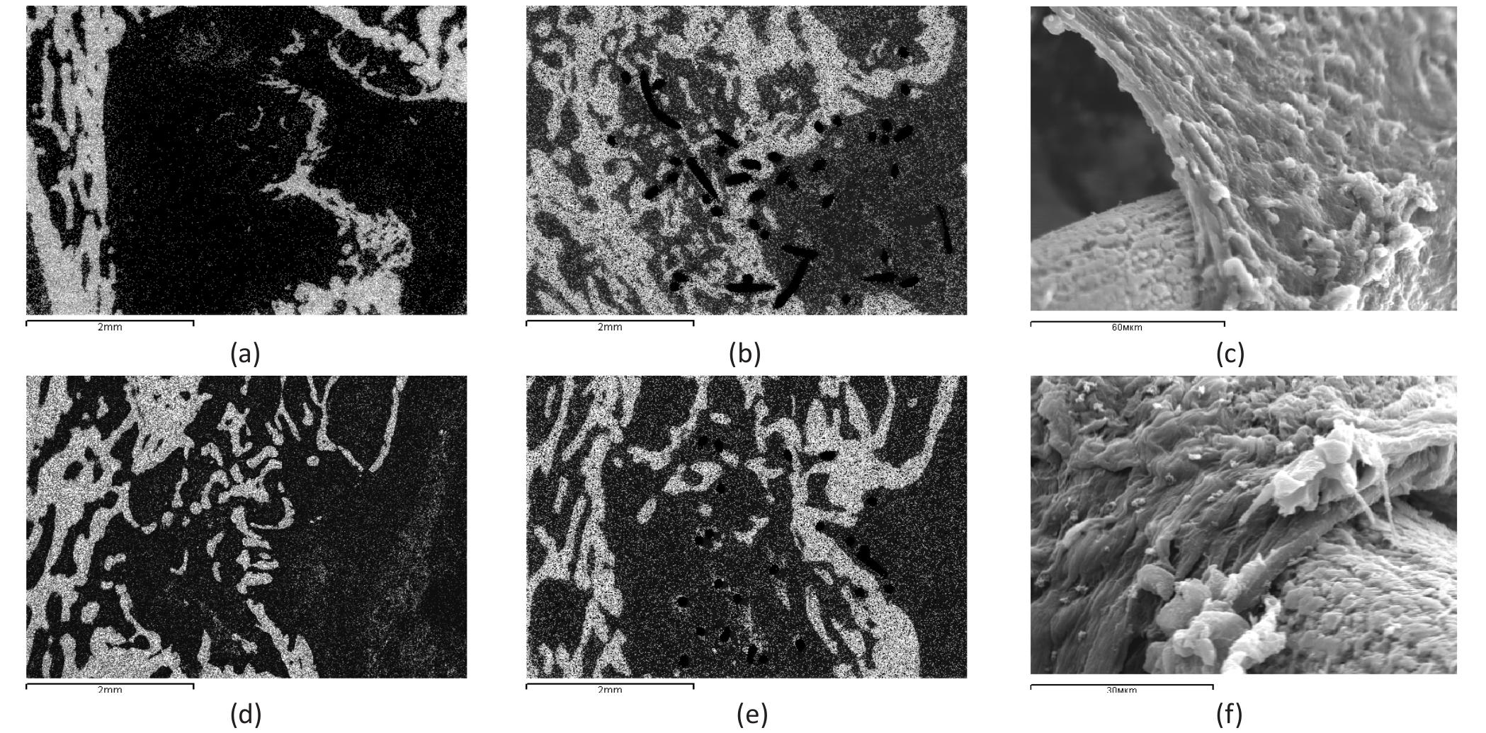 Reparative bone formation in the defect of femoral