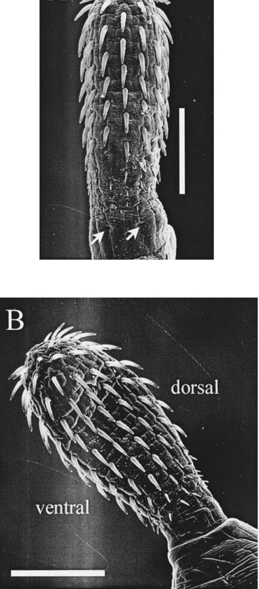 Proboscis of echinorhynchus salmonis. a. dorsal view;