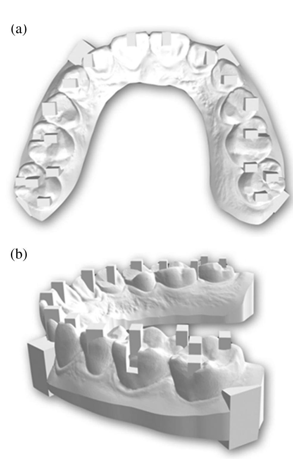 Digital dental model, occlusal view (a) and side view (b)