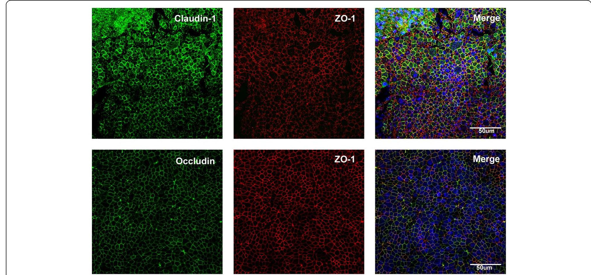 Methanol-acetone fixation of primary airway epithelial cells