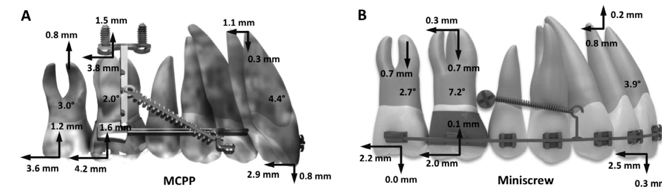 (a) mean treatment changes of the maxillary first molar and