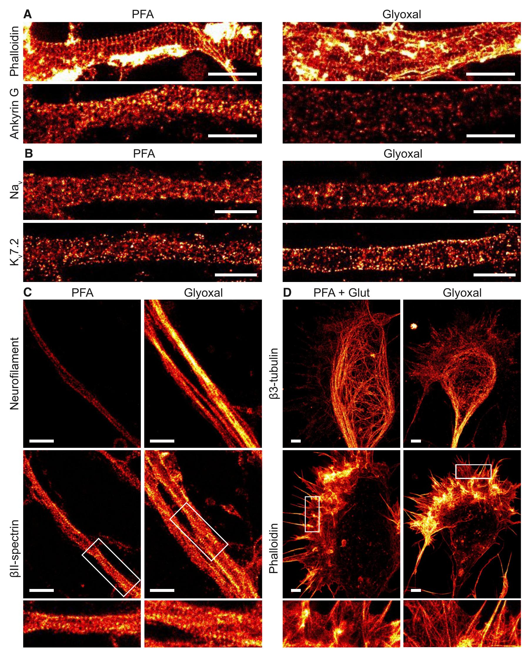 Comparison of immunostained primary hippocampal neurons in