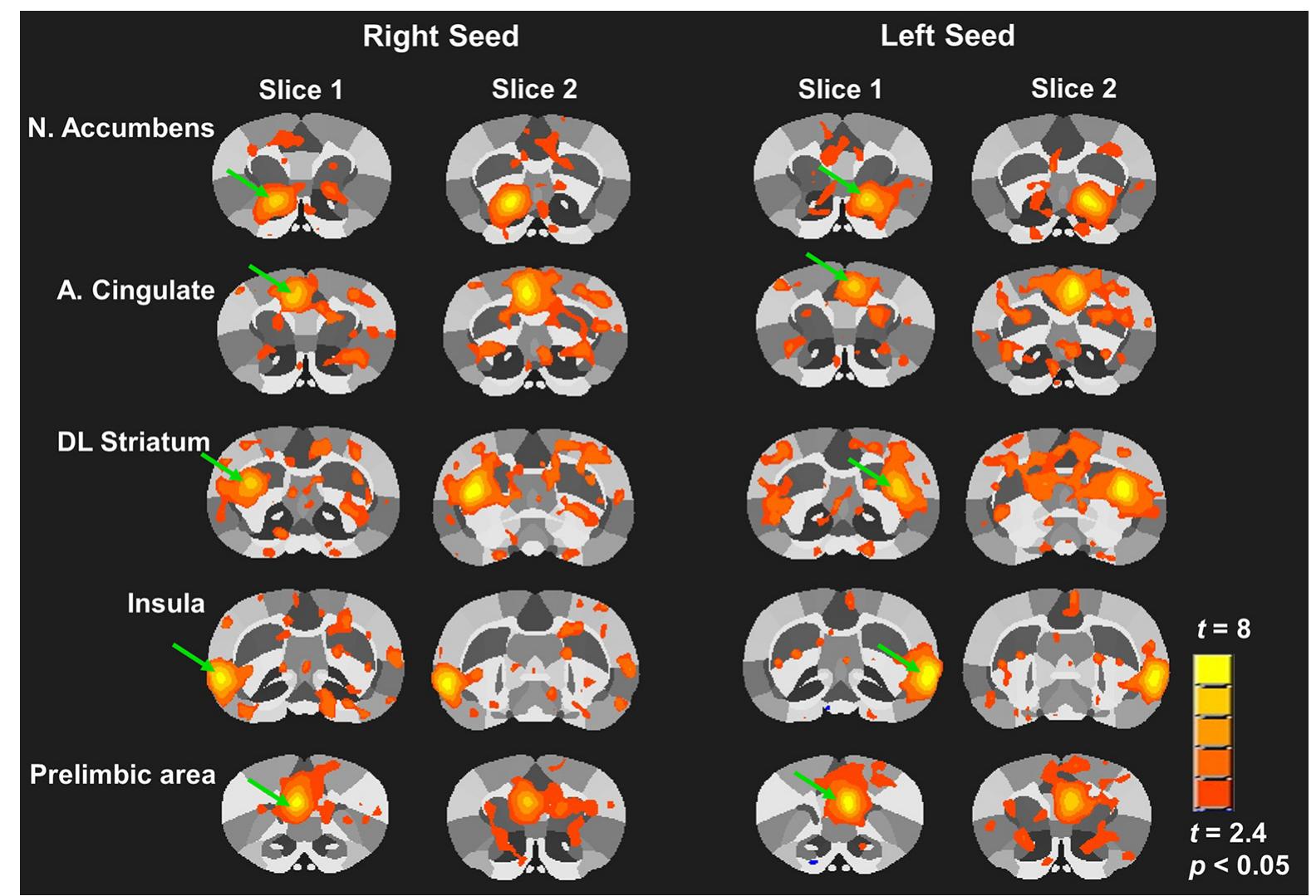 Seed-based functional connectivity maps illustrating left