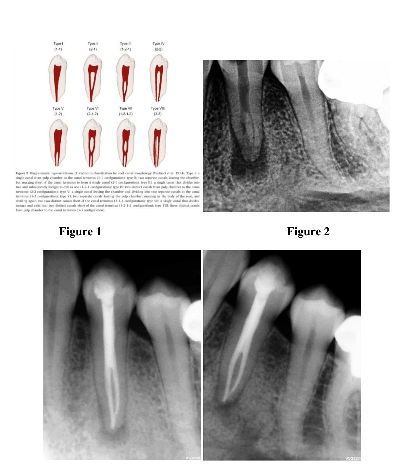 Figure 4 asian pac. j. health sci., 2018; 5(4):116-118