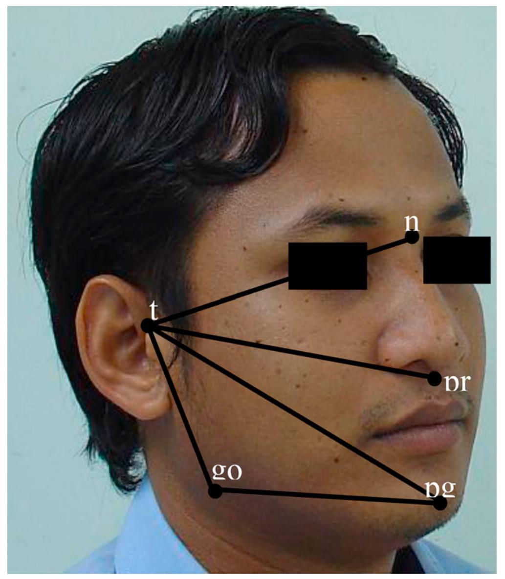 The frontal view showing the vertical and horizontal facial