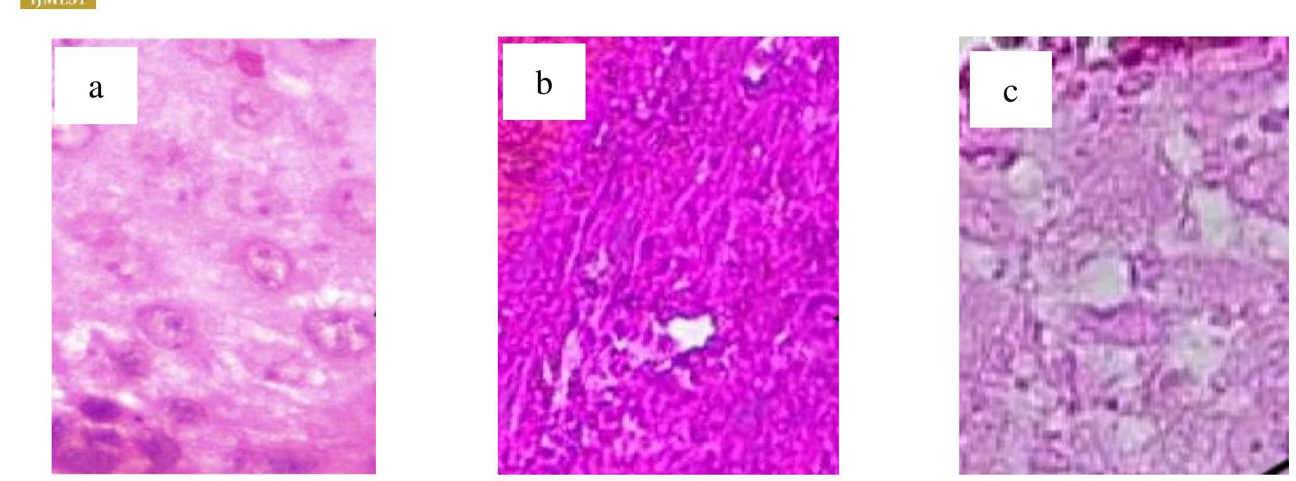 Staining cell nuclei in cervical cancer preparations with