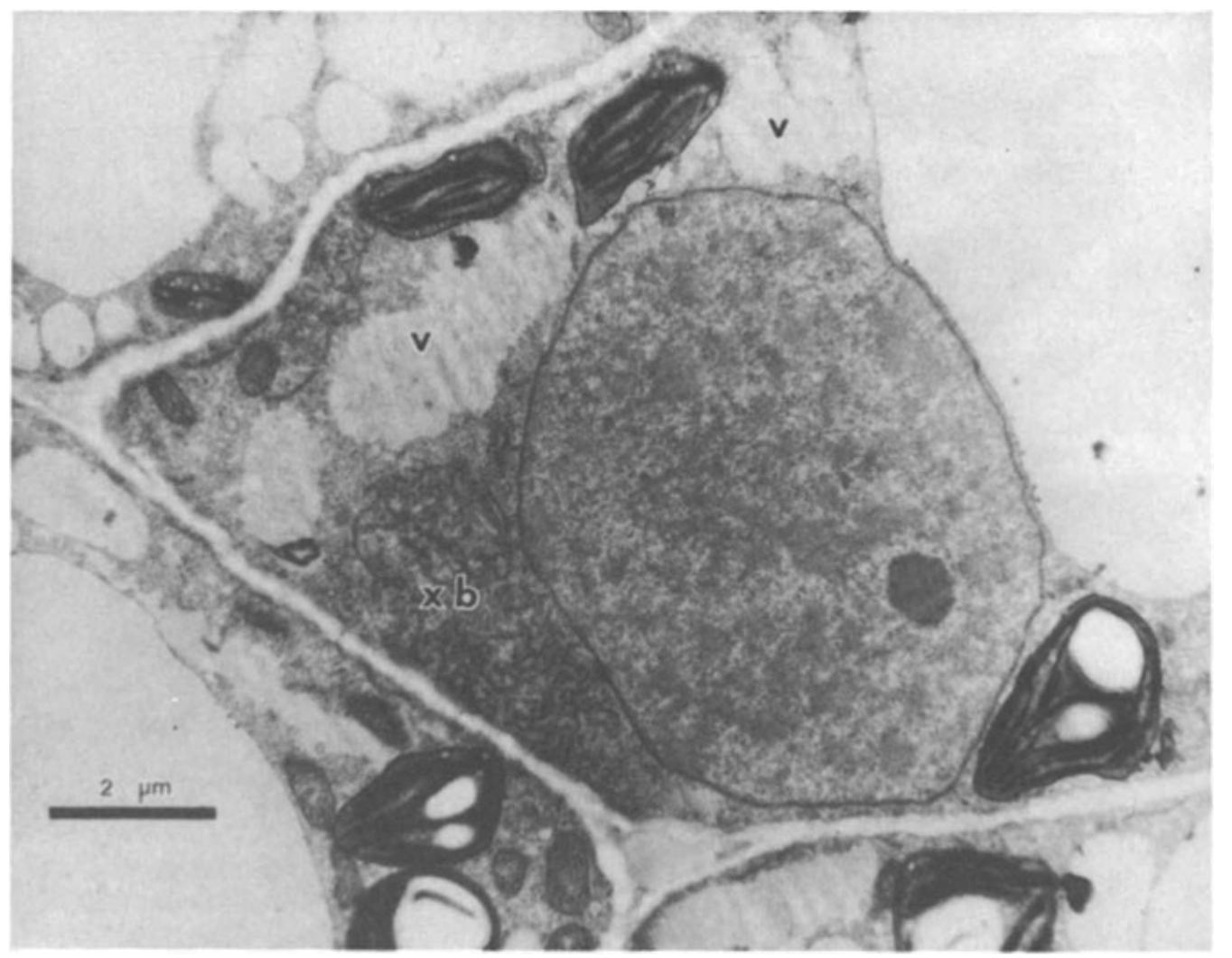 Section of tmv infected plant leaf showing cell junctions