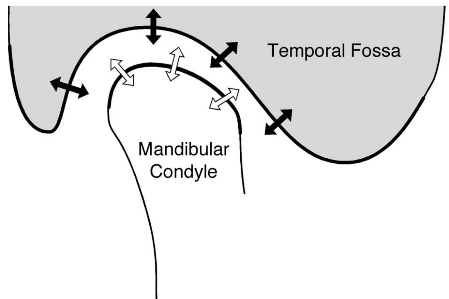 The mandibular condyle and the temporal fossa of the tmj can