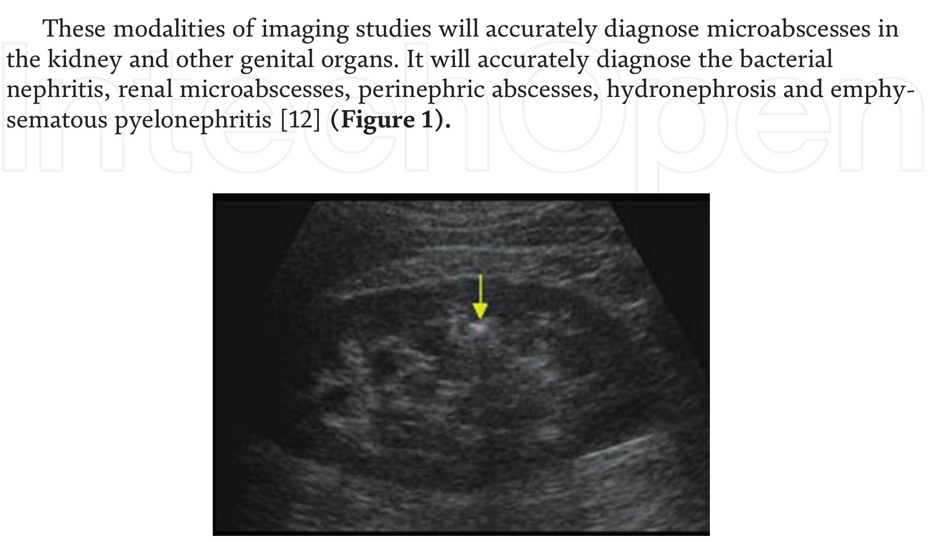 5.4.3 ct scan and mri abdomen renal usg showing calculi.