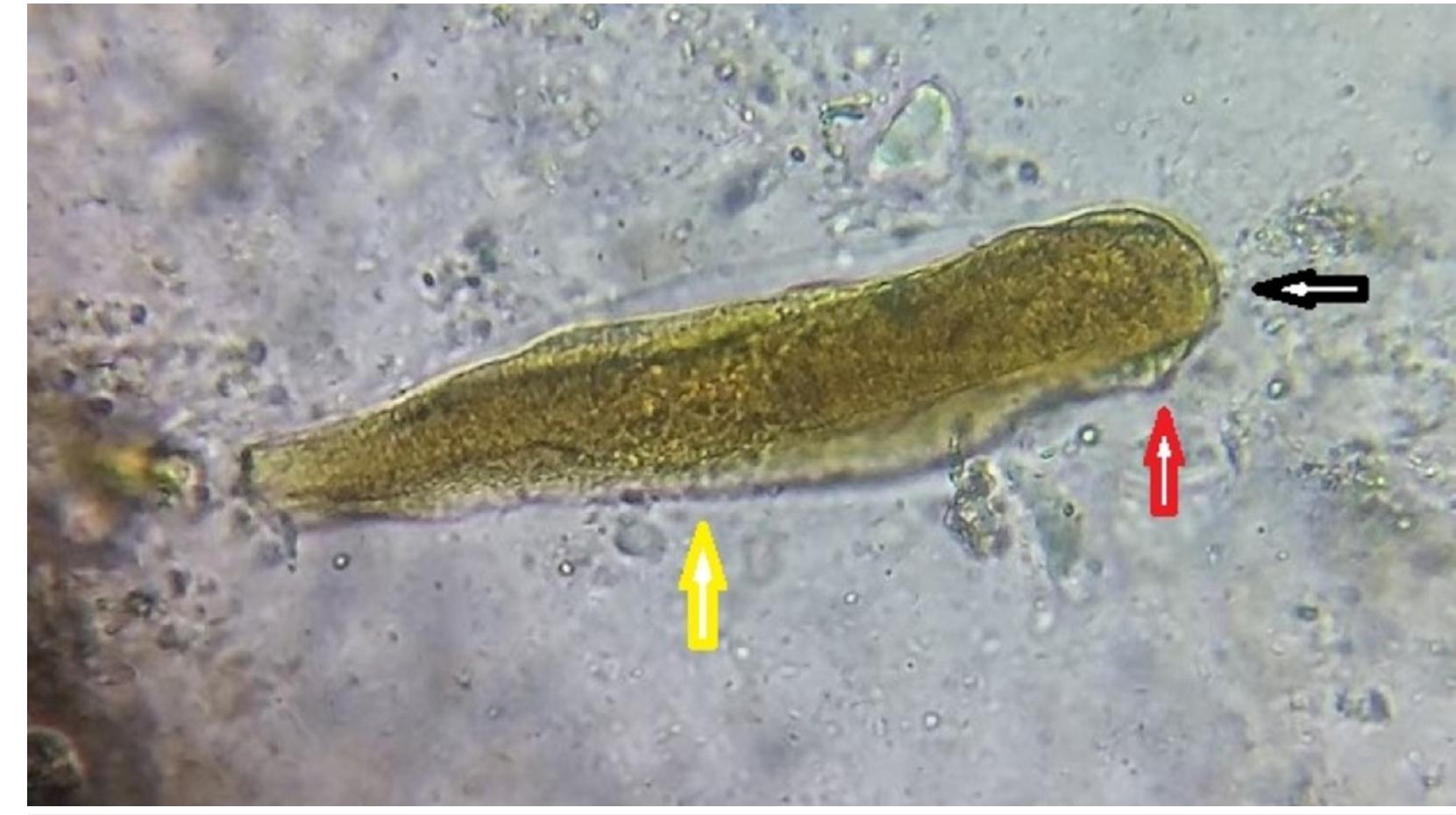 Direct stool wet mount showing the adult worm o1 hymenolepis