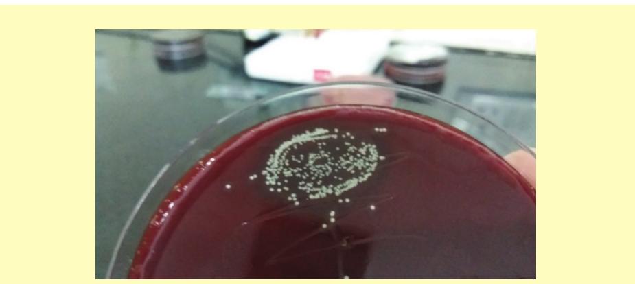 : appearance of kocuria spp on blood agar after 24 hours of