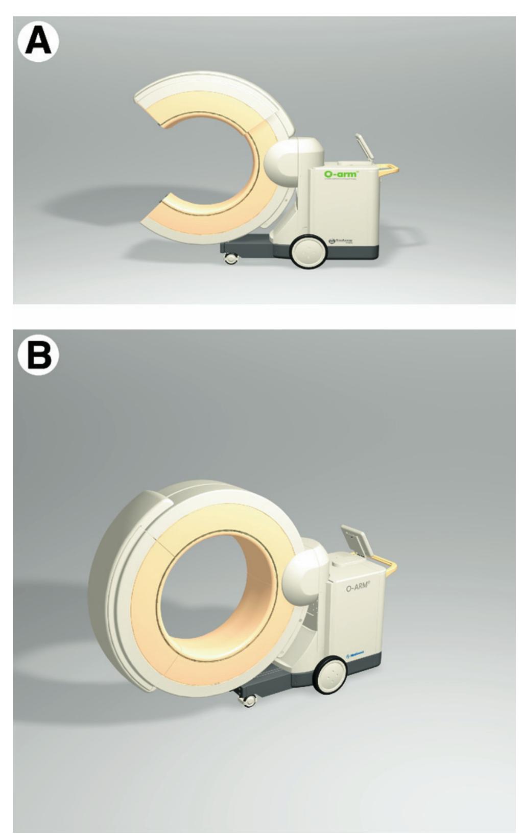 O-arm device in open (a) and closed (b) positions. (images