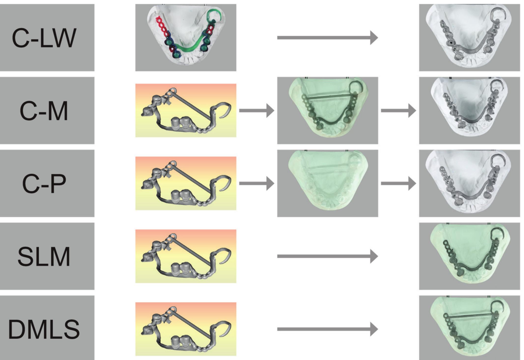Workflow of five manufacturing procedures for removable