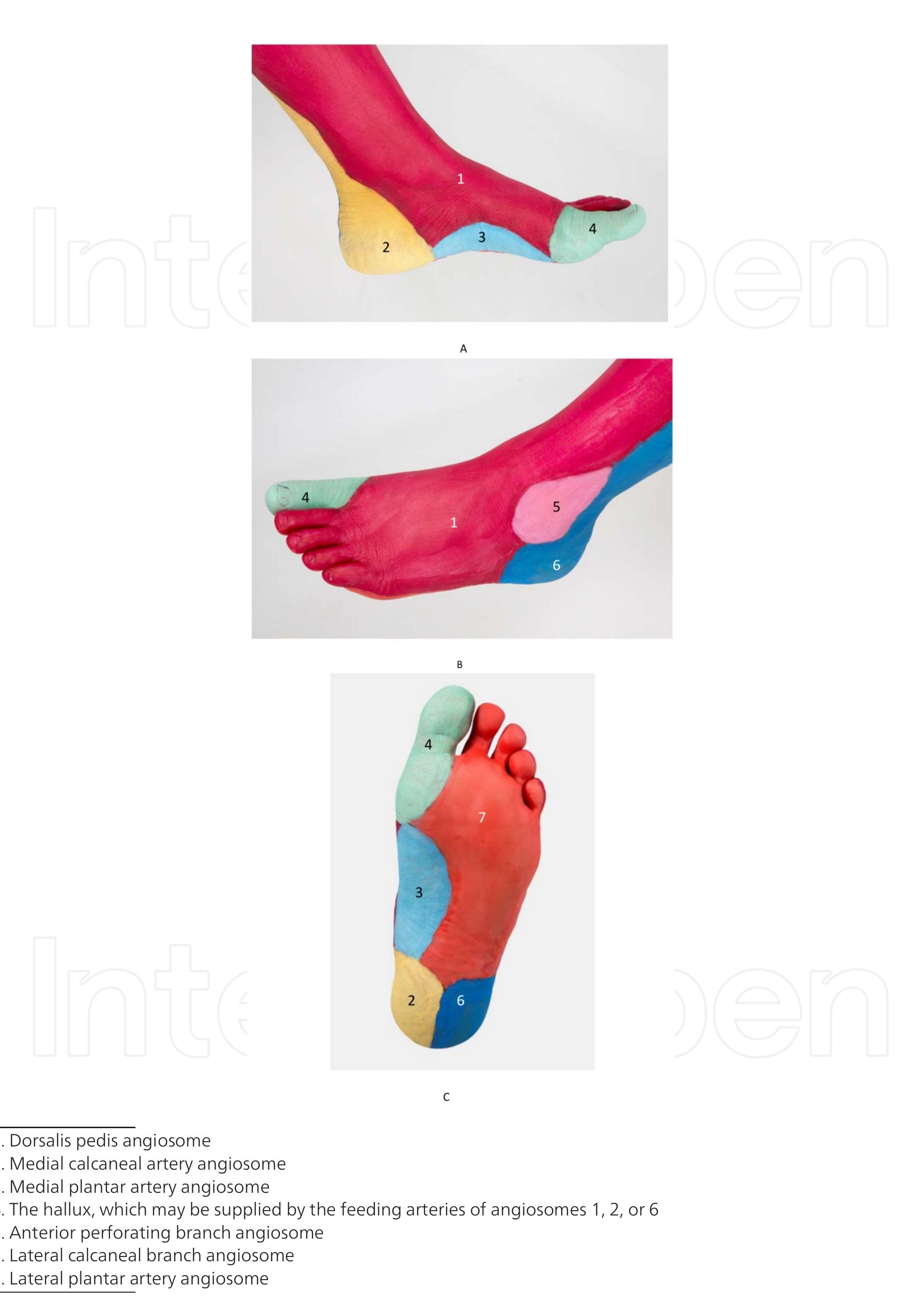 Angiosomes shown on the surface of the foot. a. medial view,