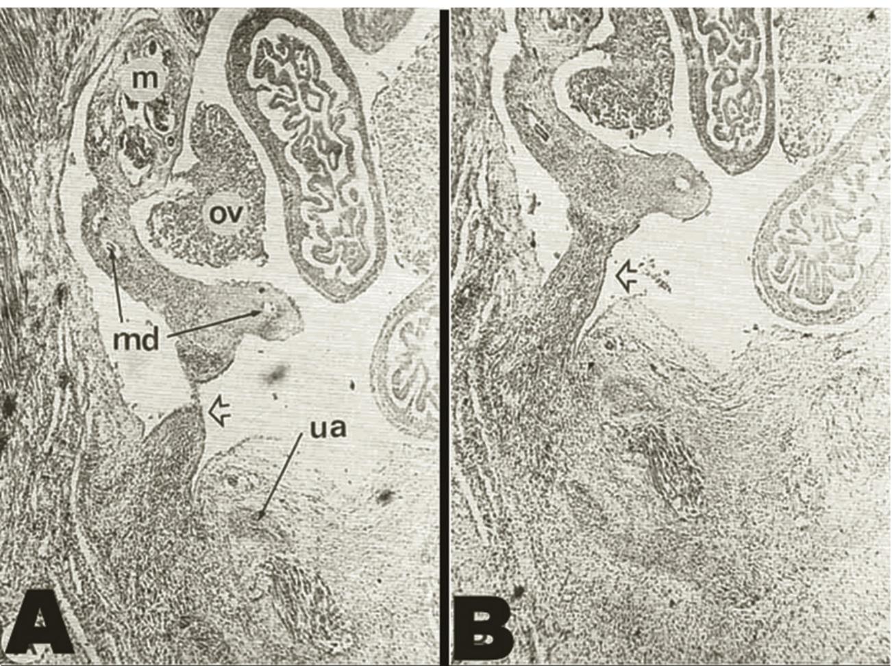 (PDF) The female gubernaculum: role in the embryology and development ...