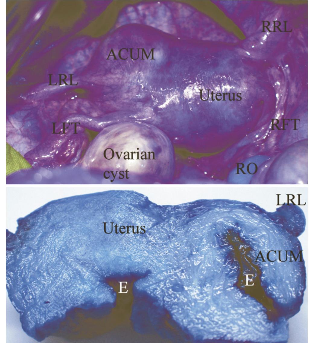 (PDF) The female gubernaculum: role in the embryology and development ...