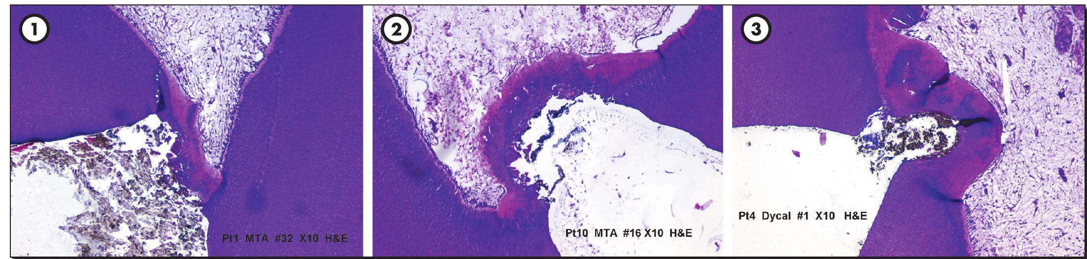 A representative sample of the histological features after