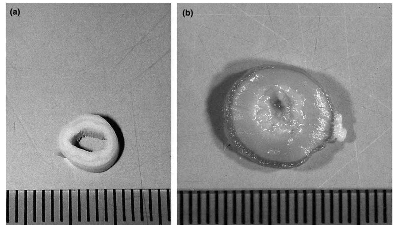 (a) control. cross-section of small intestine from a normal