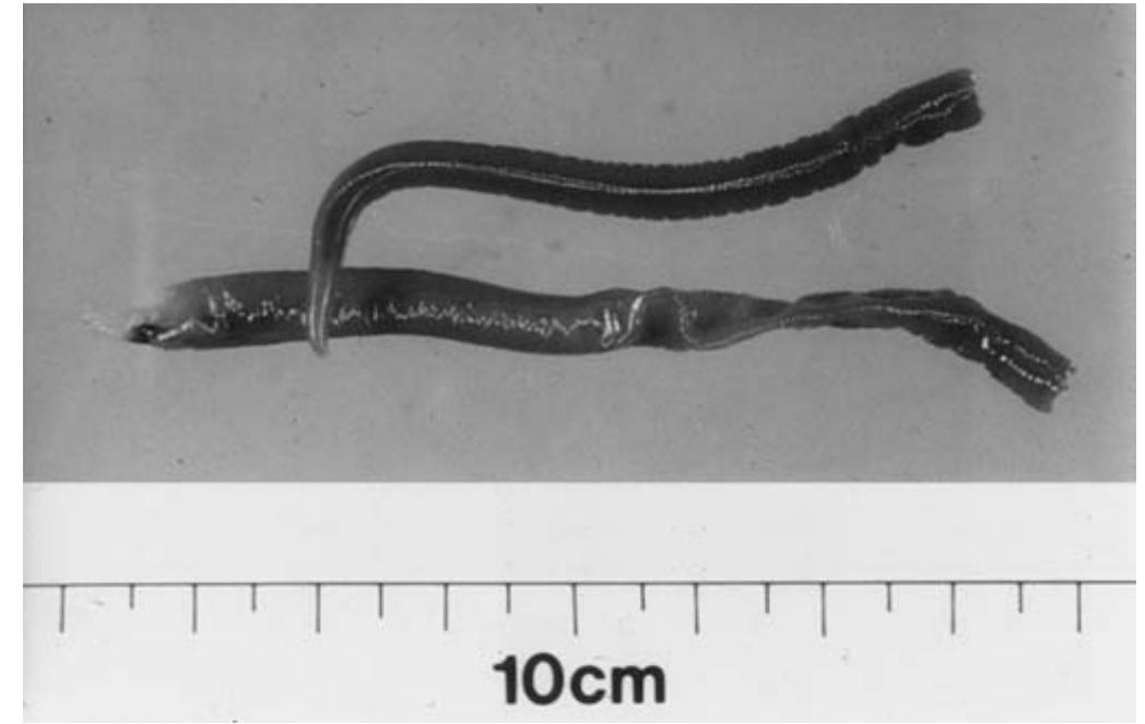 Photograph of ascaris pair. note the slender male and the
