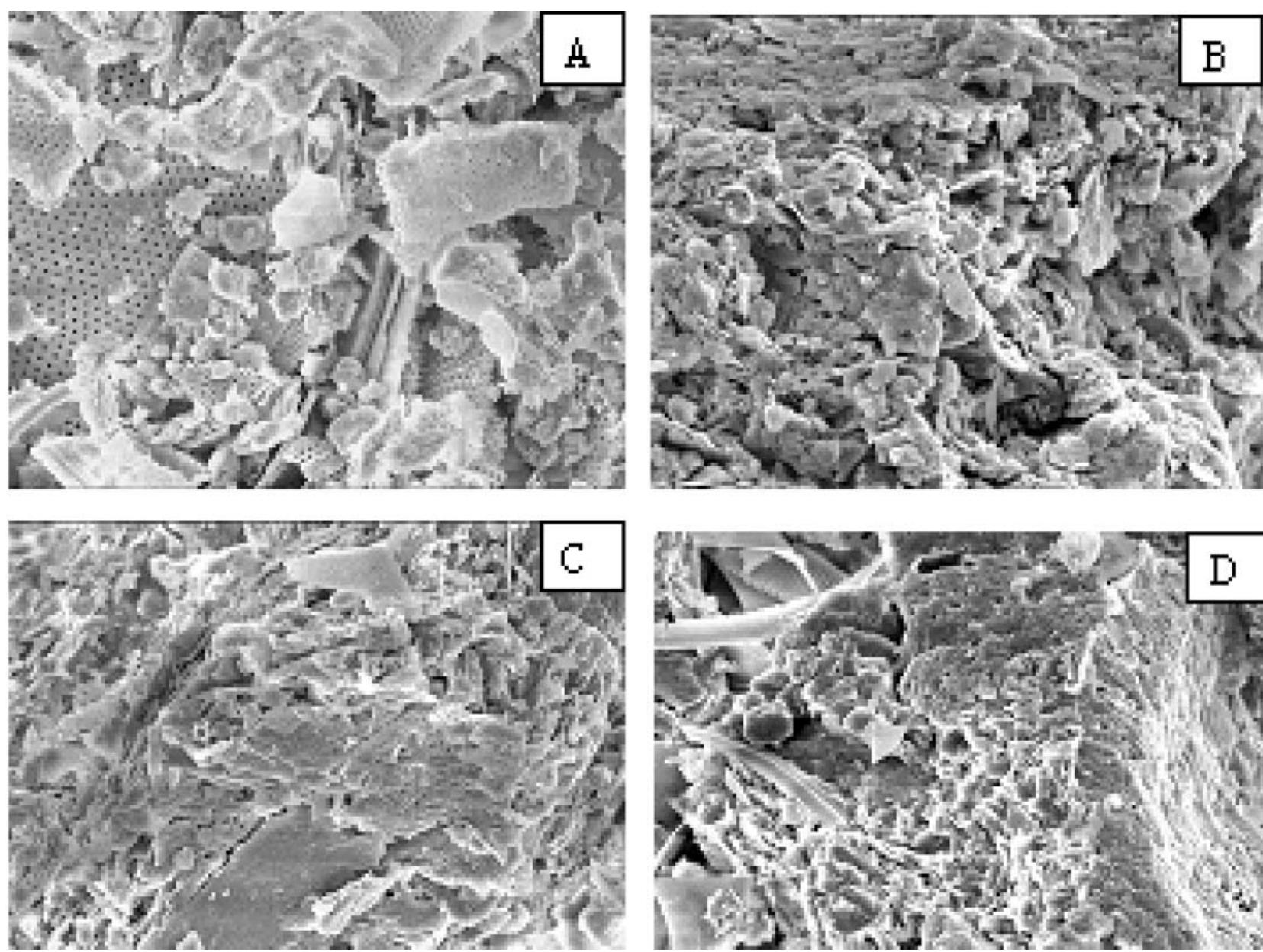 Scanning electron microscope (magnification 2000 x ) of,