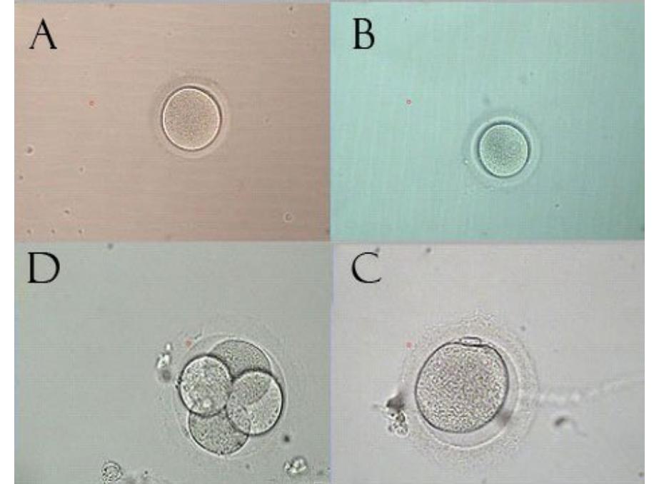 (a, b, c & d): a) gv oocyte , b) mi oocyte , c) mii oocyte