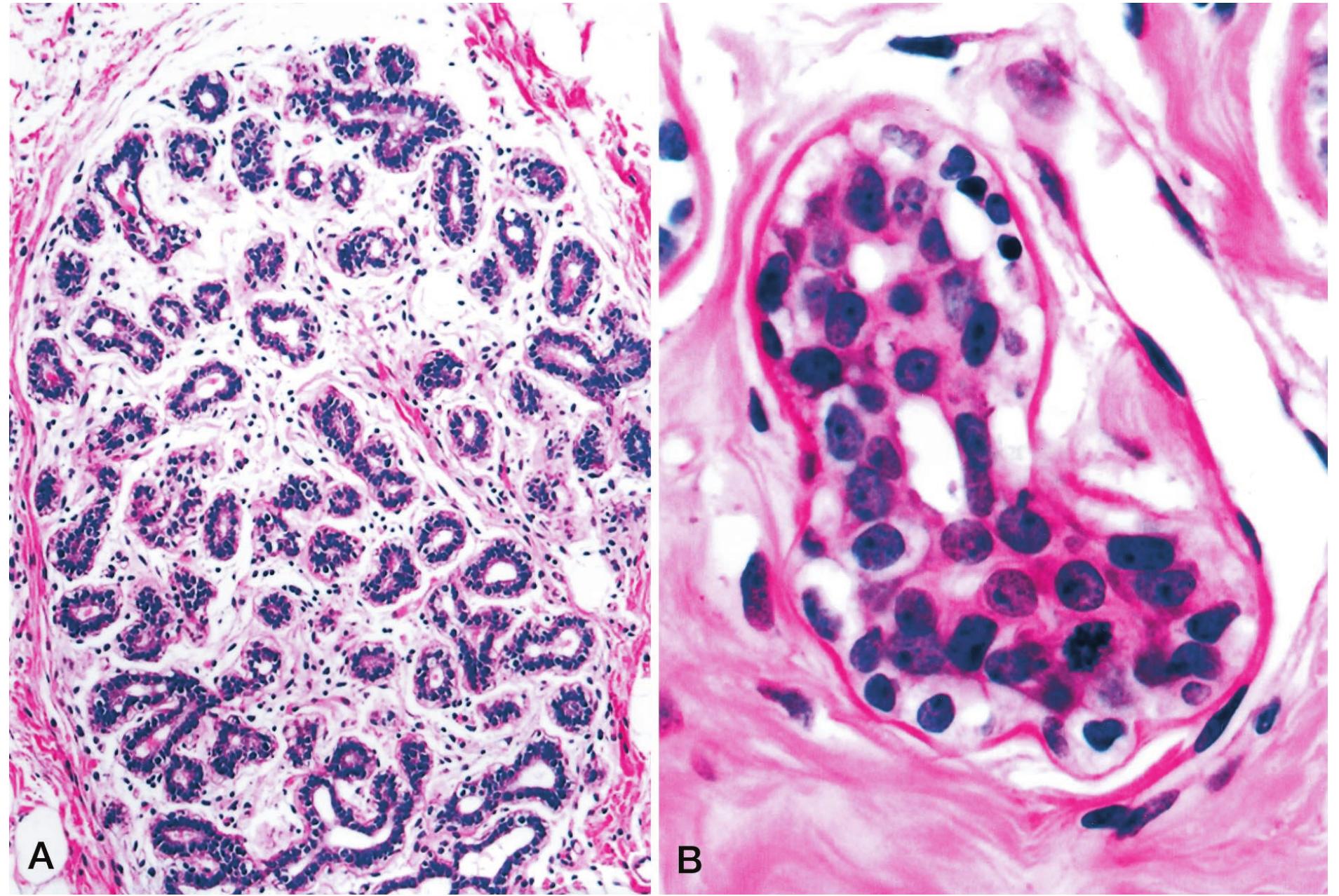 Stage 4 of menstrual cycle. a, low magnification of lobule