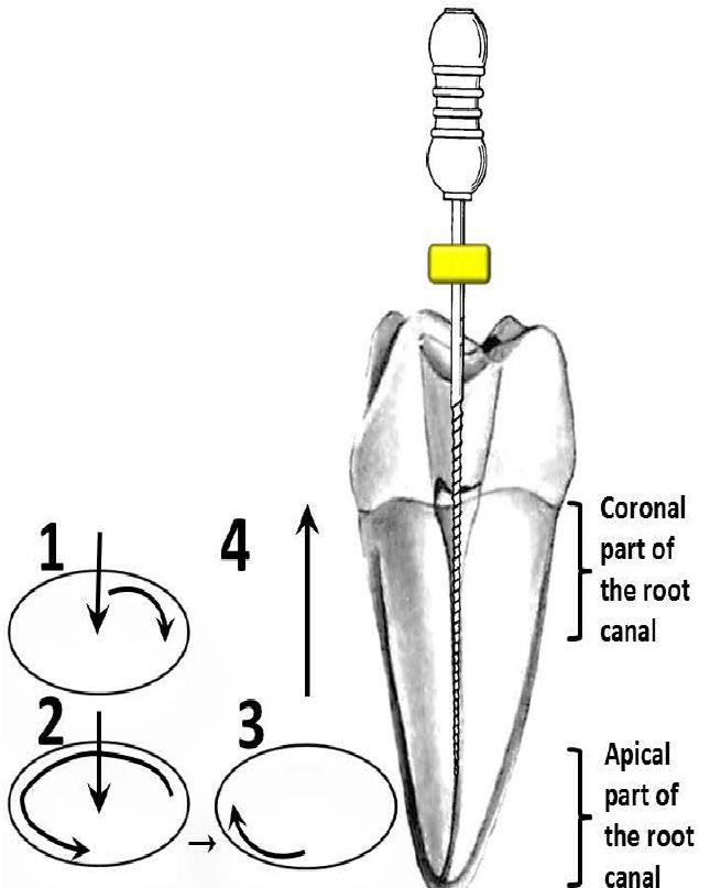(2). a diagram summarizing the three key movements in the
