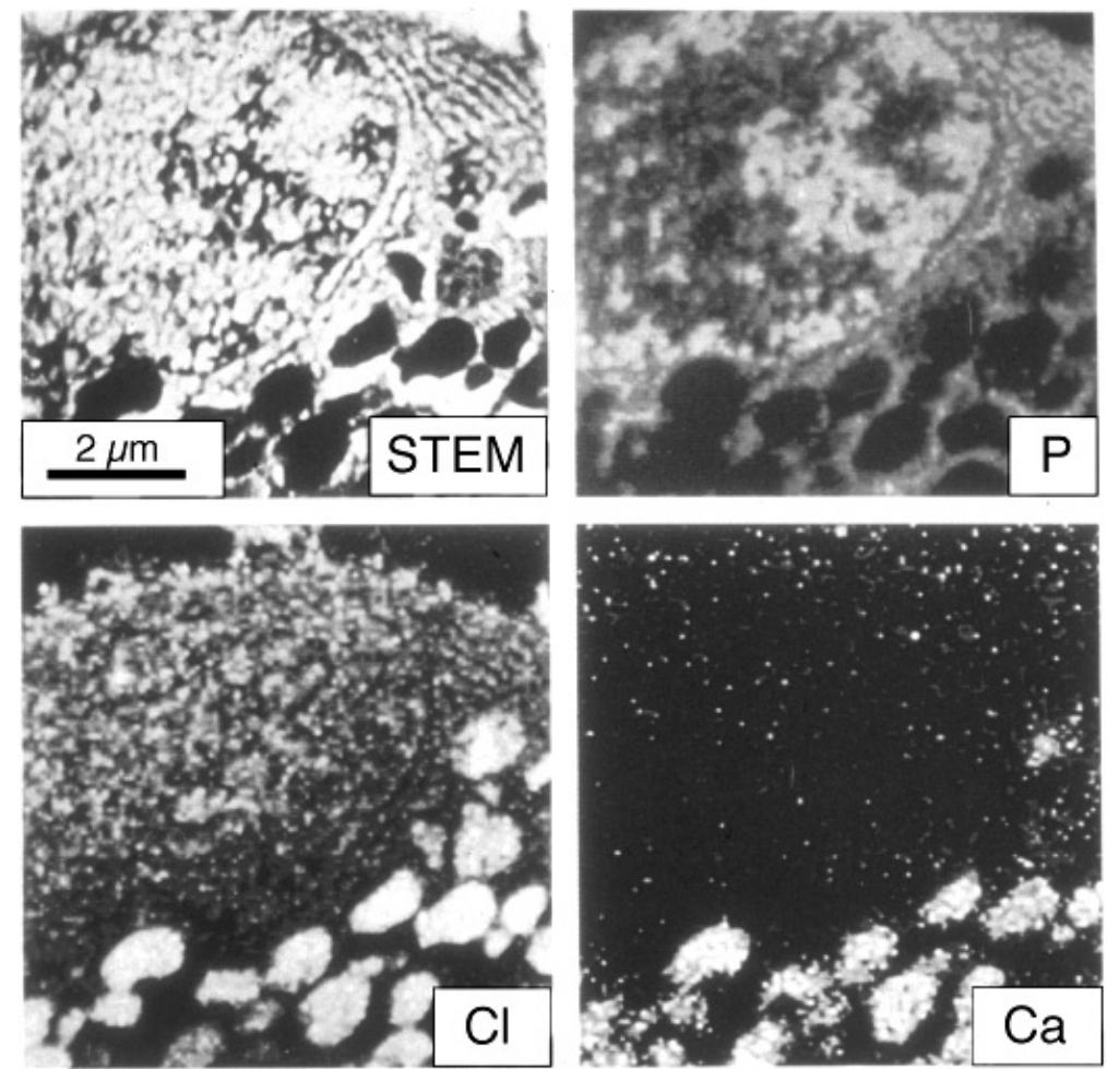 Digital x-ray map of a freeze-dried cryosection of a rat