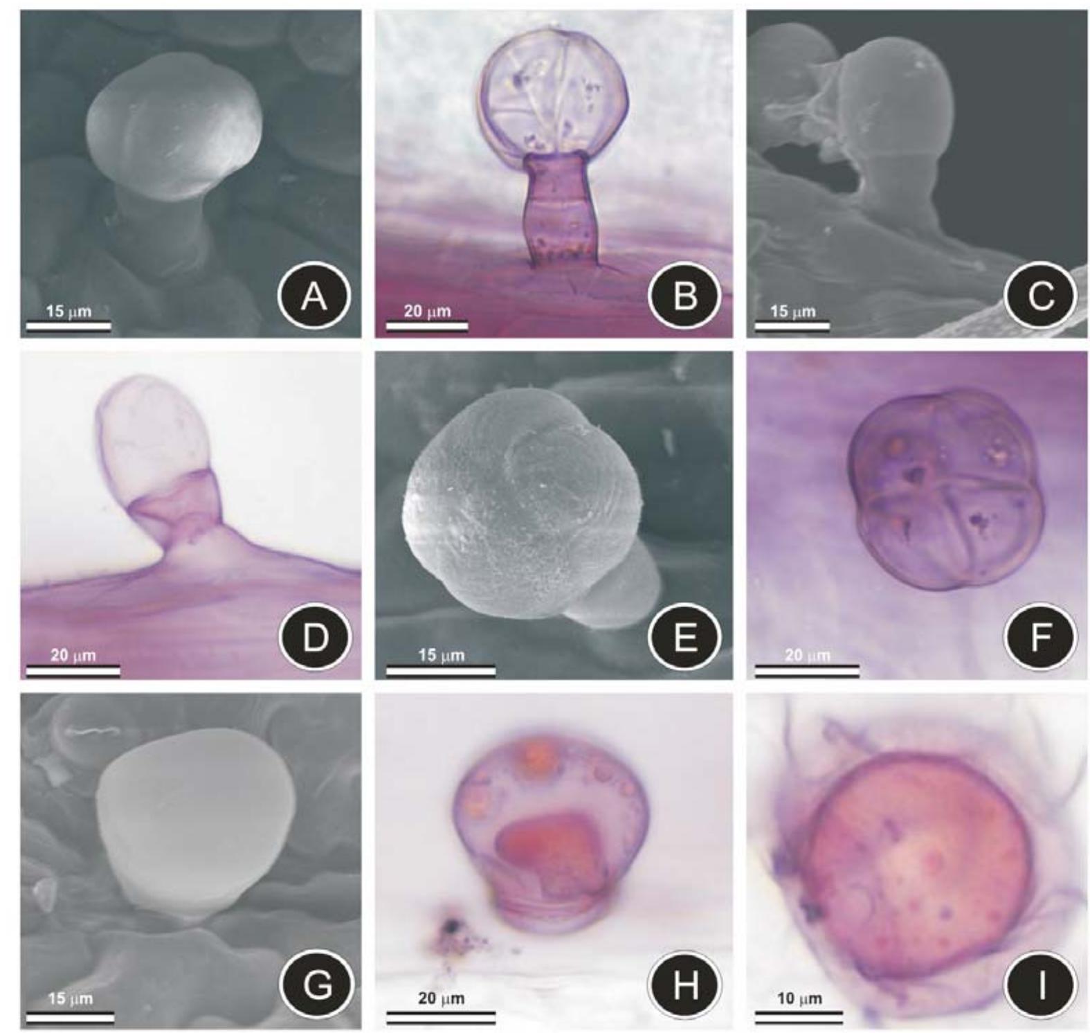 - types of glandular trichomes in lantana radula. a, c, e