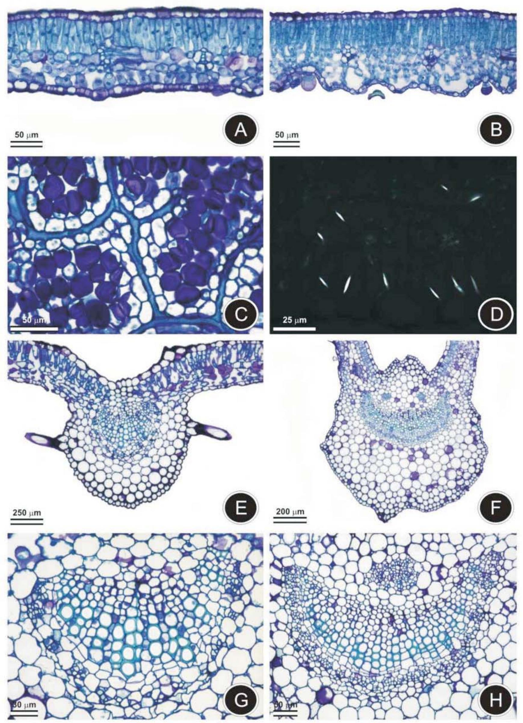 Figure 6 - from Foliar anatomy of the species Lantana camara